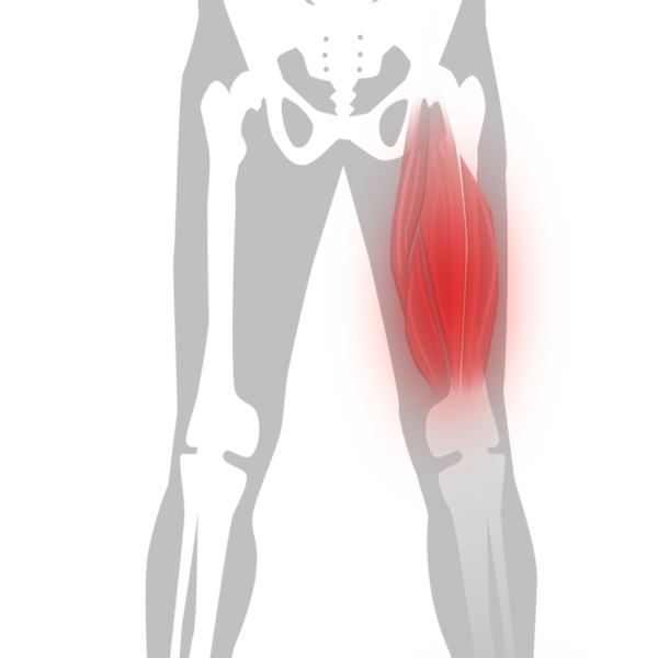 Ont i knät - låret - vaden - Läs mer i Skadeguiden | REHABgrossisten