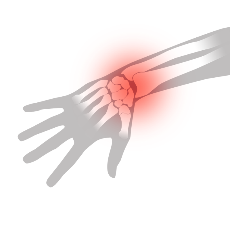 Skadeguiden | REHABgrossisten